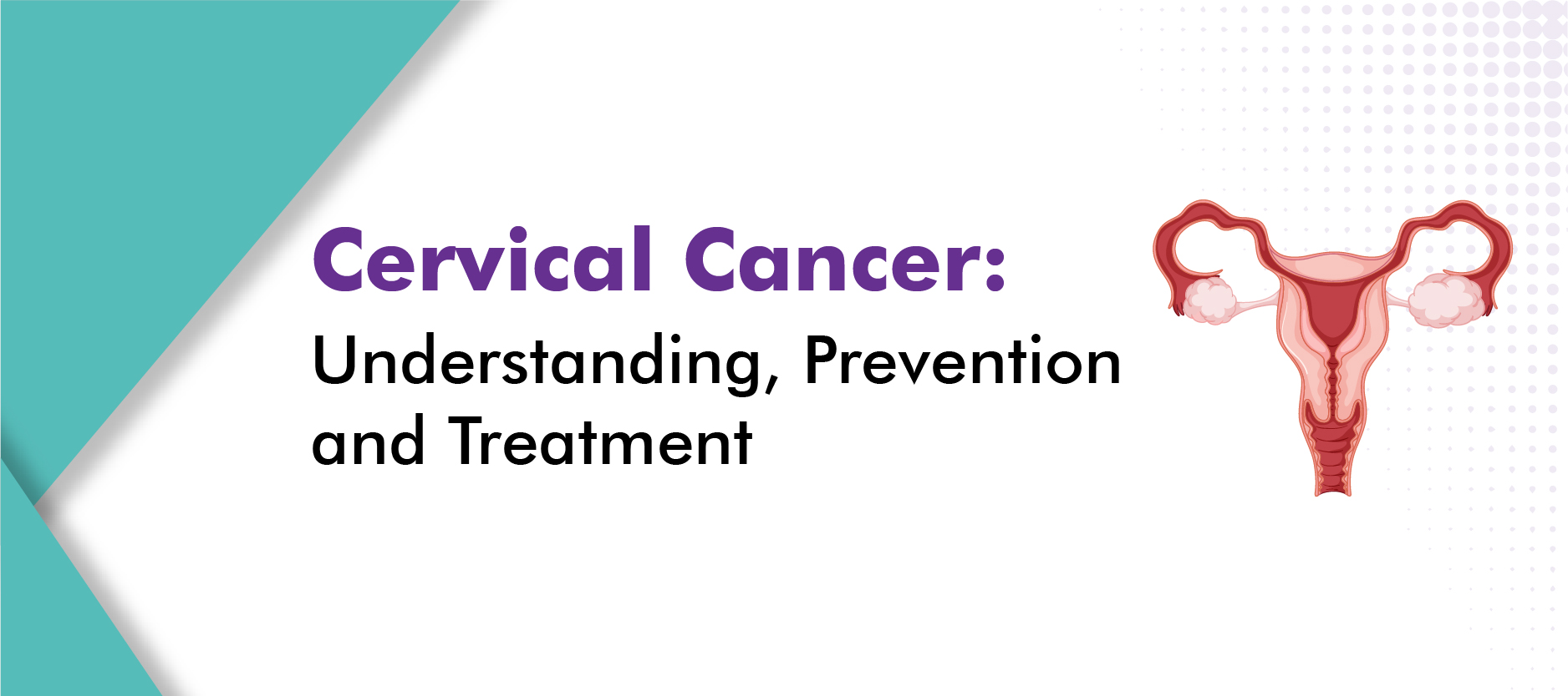 Cervical Cancer: Understanding, Prevention, and Treatment